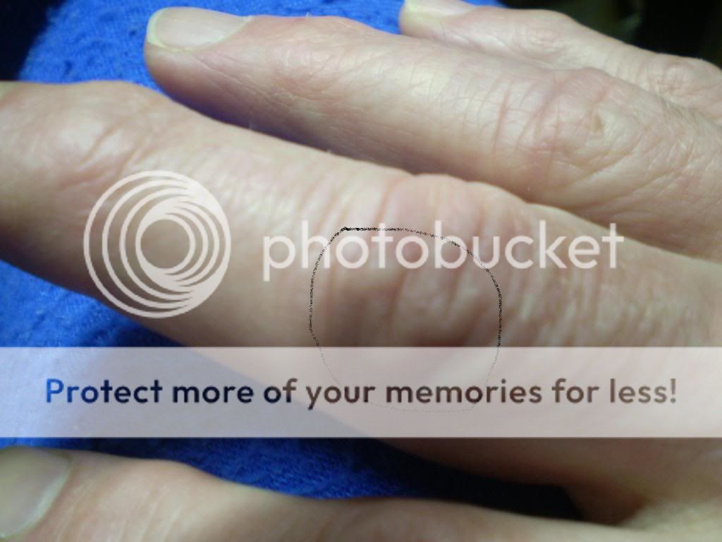 What's the worst electrical shock you've received? | All About Circuits